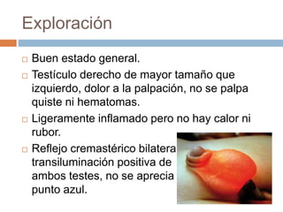 Escroto agudo | PPTX
