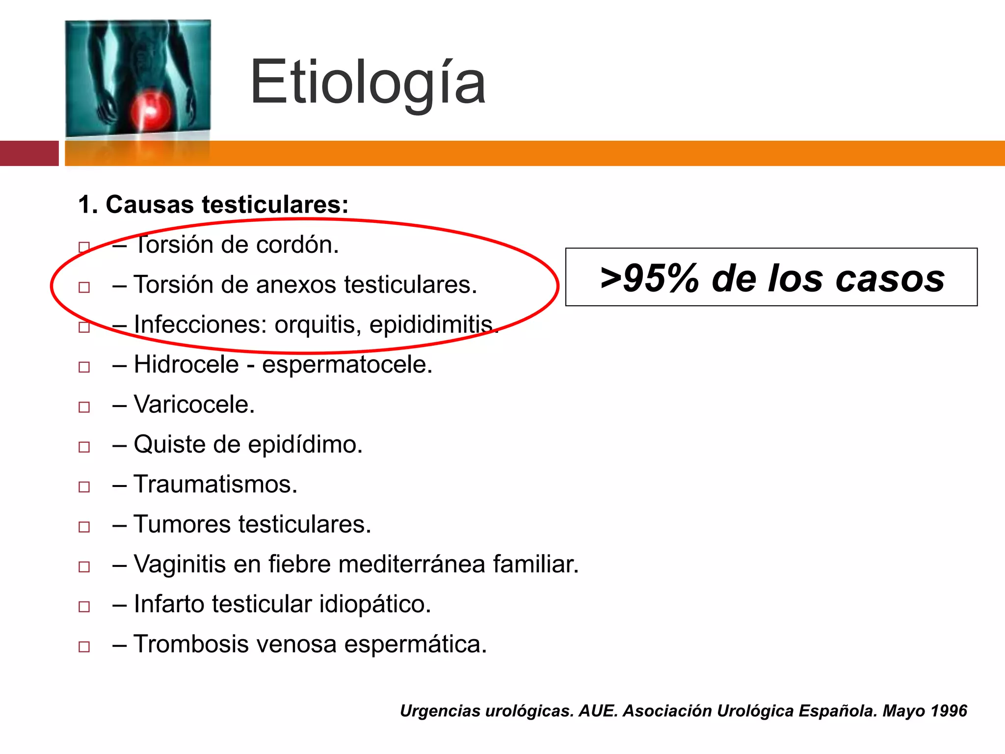 Urgencias Urologicas - Escroto Agudo | PPTX