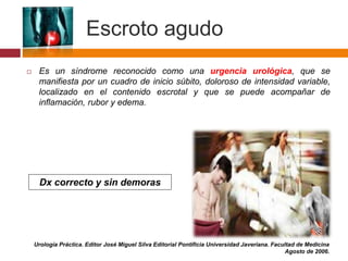 Urgencias Urologicas - Escroto Agudo | PPTX