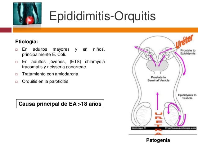 Enfermedades En El Escroto Imagen