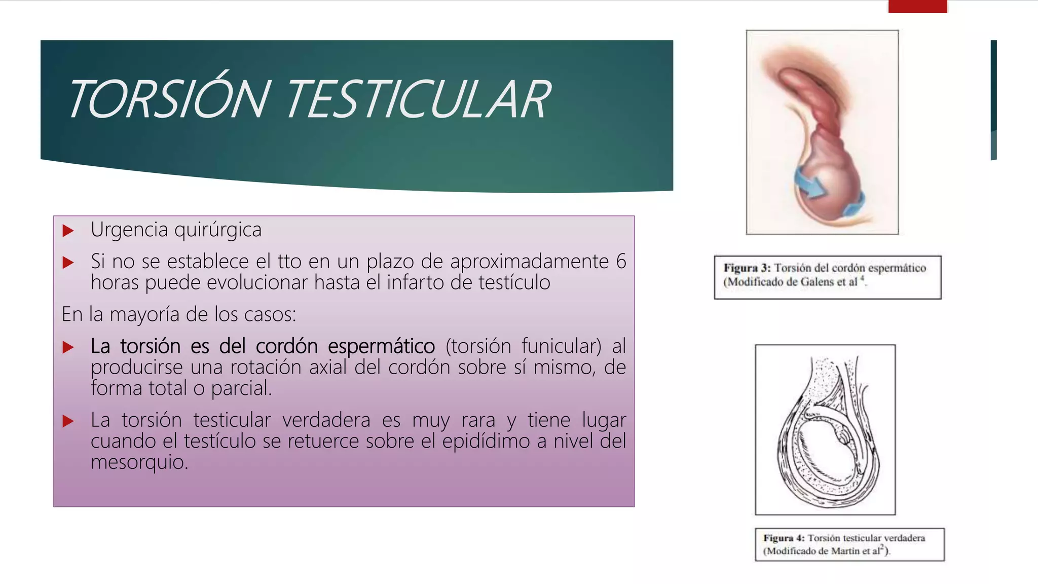Escroto agudo | PPTX