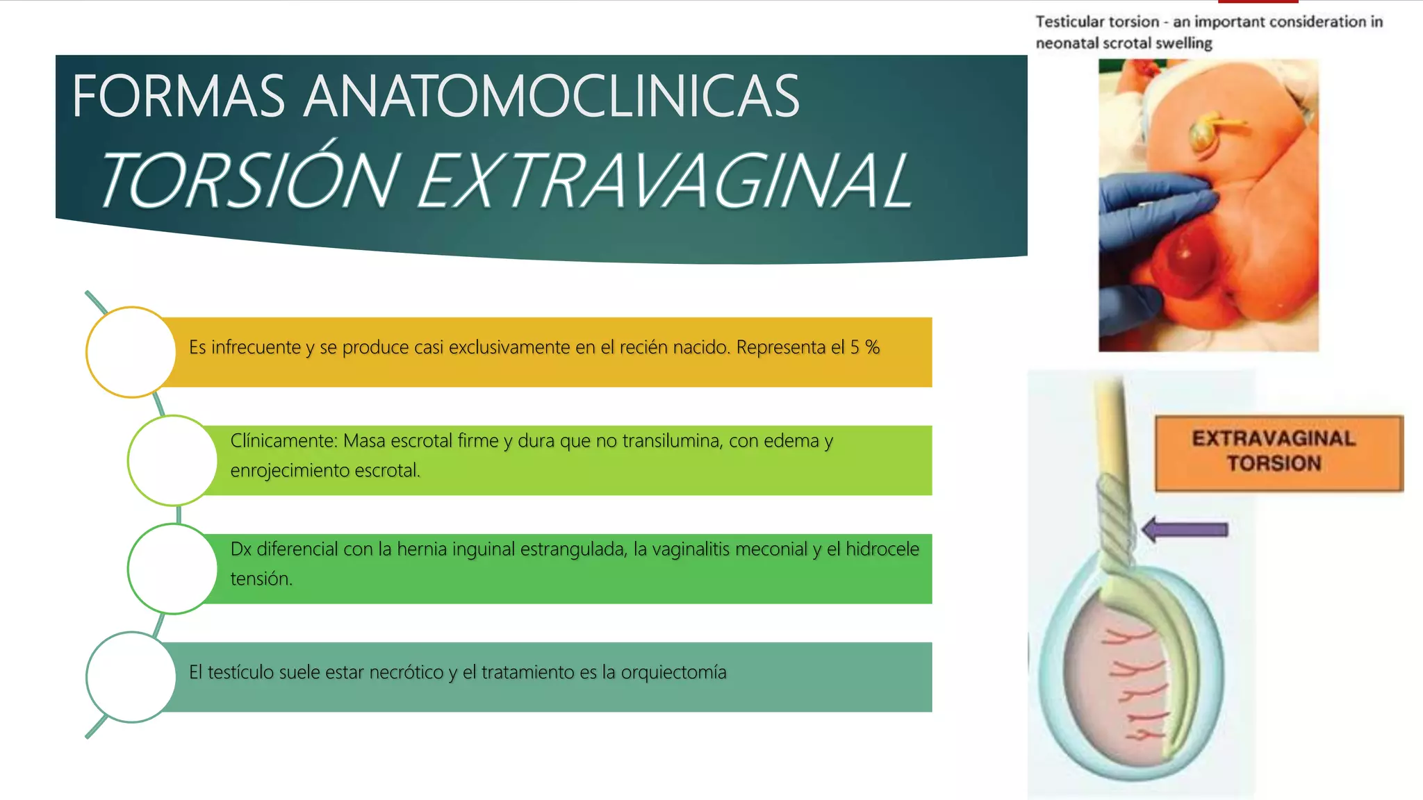 Escroto agudo | PPTX