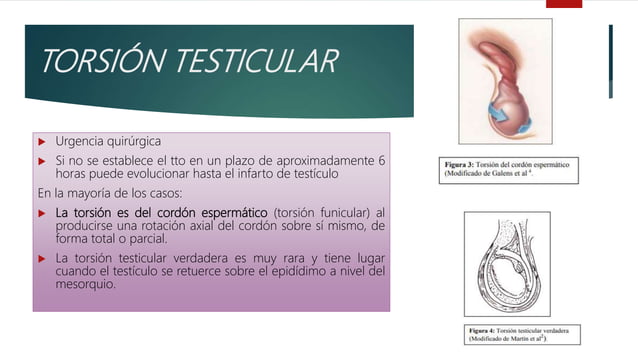 Escroto agudo | PPTX