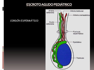 Escroto agudo en pediatría | PPTX