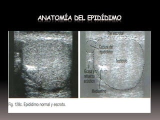 Escroto agudo en pediatría | PPTX