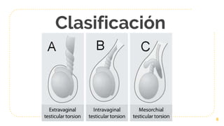 Escroto agudo urologia | PPTX