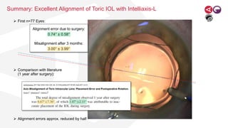 Alignment of Toric IOL via automated Femtosecond Laser-Assisted Capsular Marks | PPT