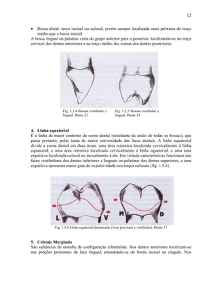 Escultura dental com auxílio do método geométrico | PDF