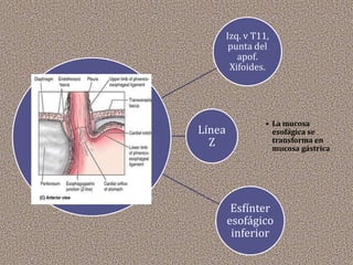 Esófago | PPTX