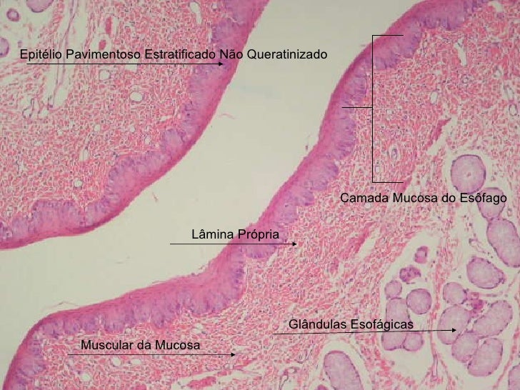 EsôFago TransiçãO
