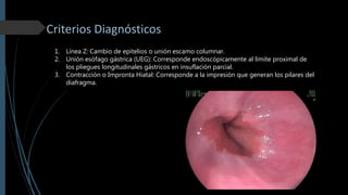 Esófago de barrett | PPTX