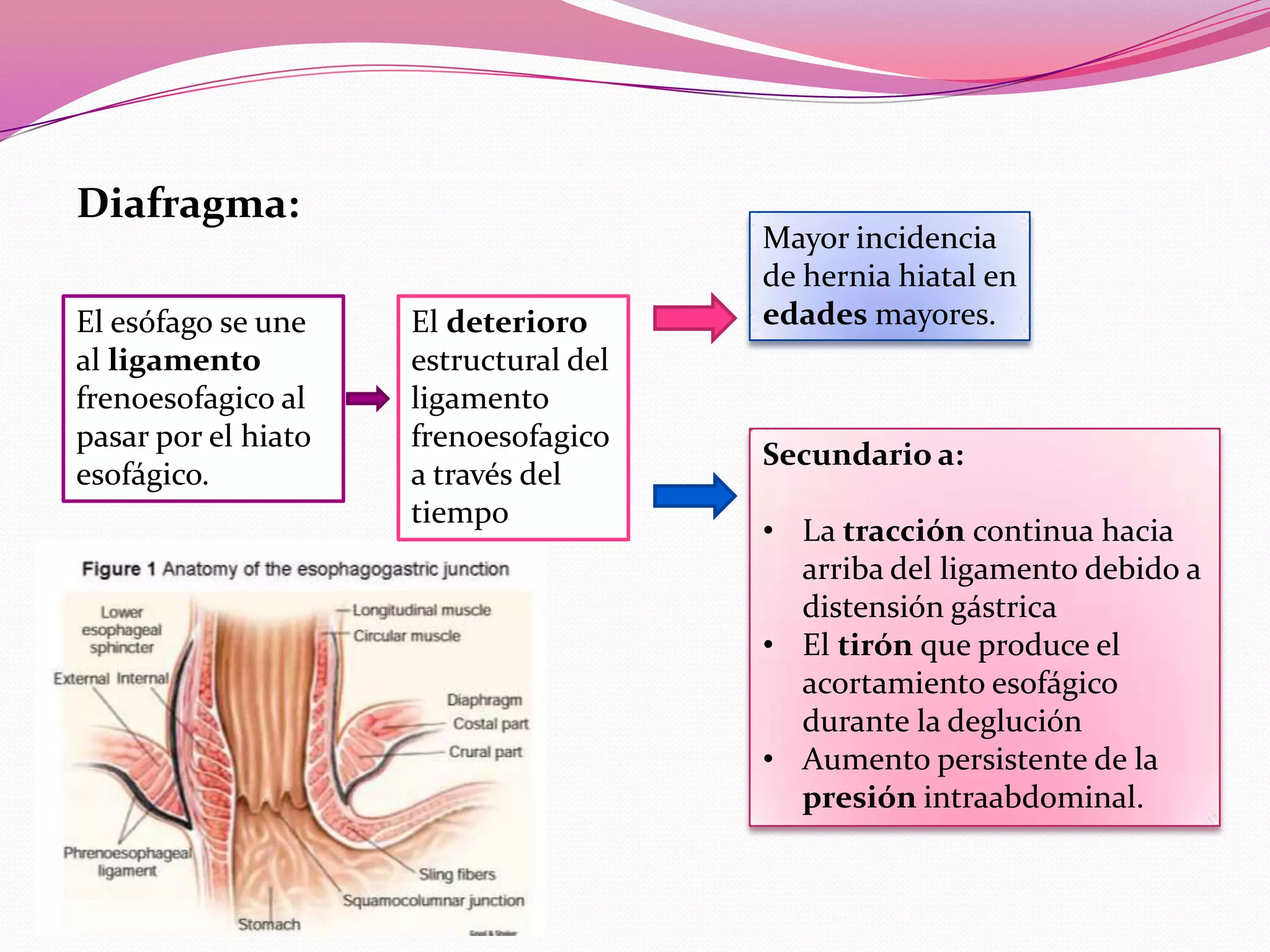 Esófago, hernia hiatal, y acalasia | PPTX