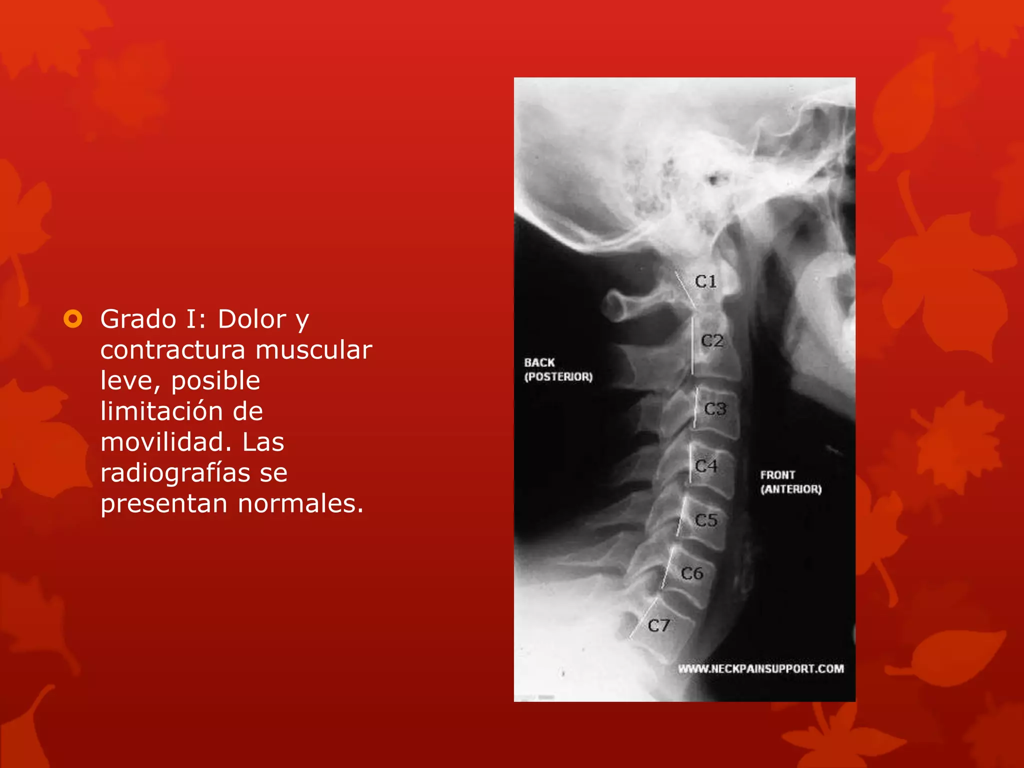 Esguince cervical | PPTX