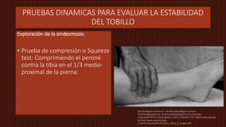 Esguince de tobillo | PPTX
