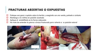 Esguinces Luxacion y Fracturas-CP1.pdf