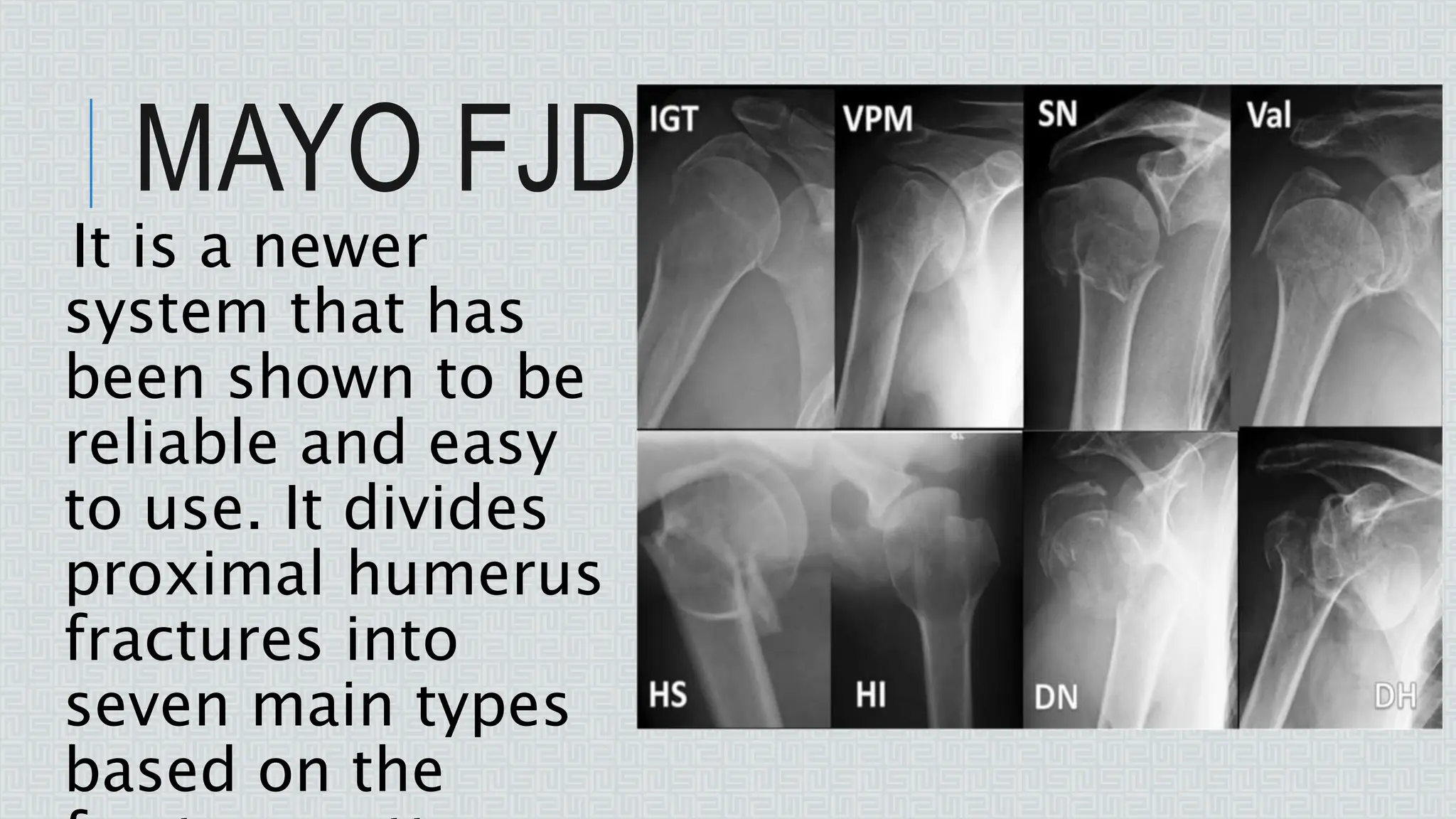 anapath of proximal humerus fractures.pptx
