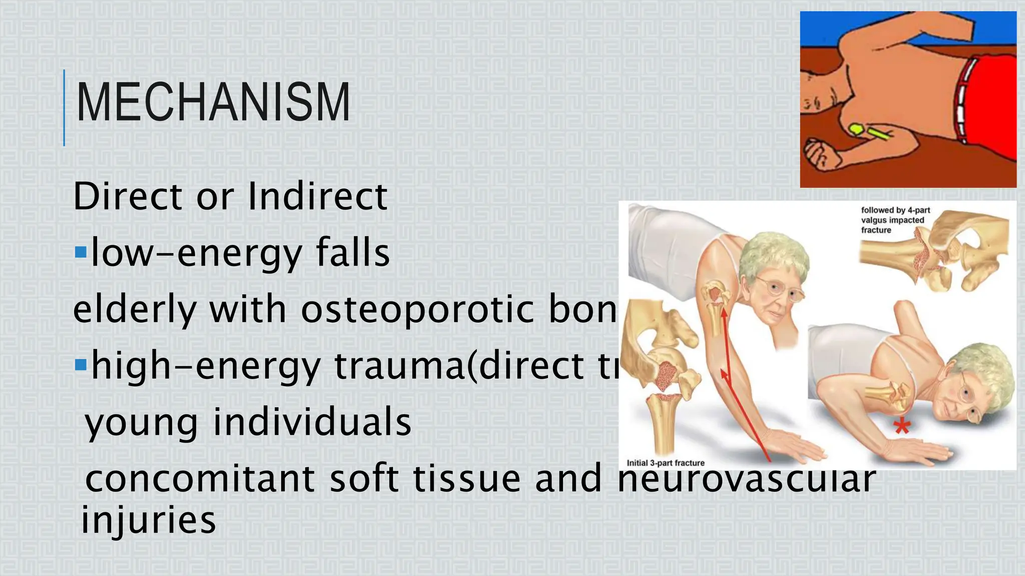 anapath of proximal humerus fractures.pptx