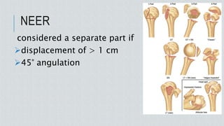 anapath of proximal humerus fractures.pptx
