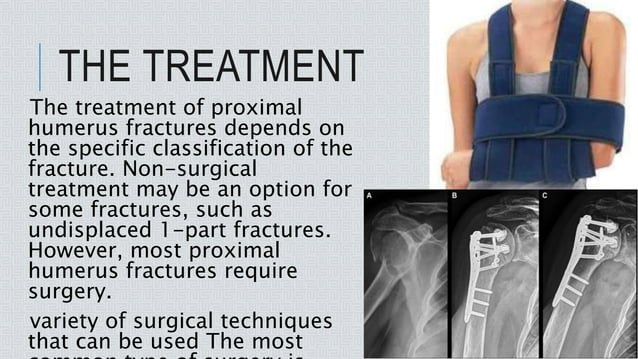 anapath of proximal humerus fractures.pptx