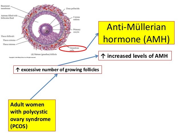 Recent 2018 ESHRE & ASRM evidence based guidelines for PCOS assement