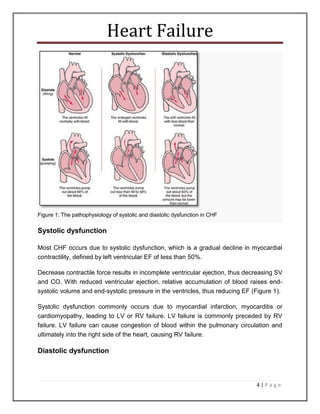 M4 - Heart failure | PDF