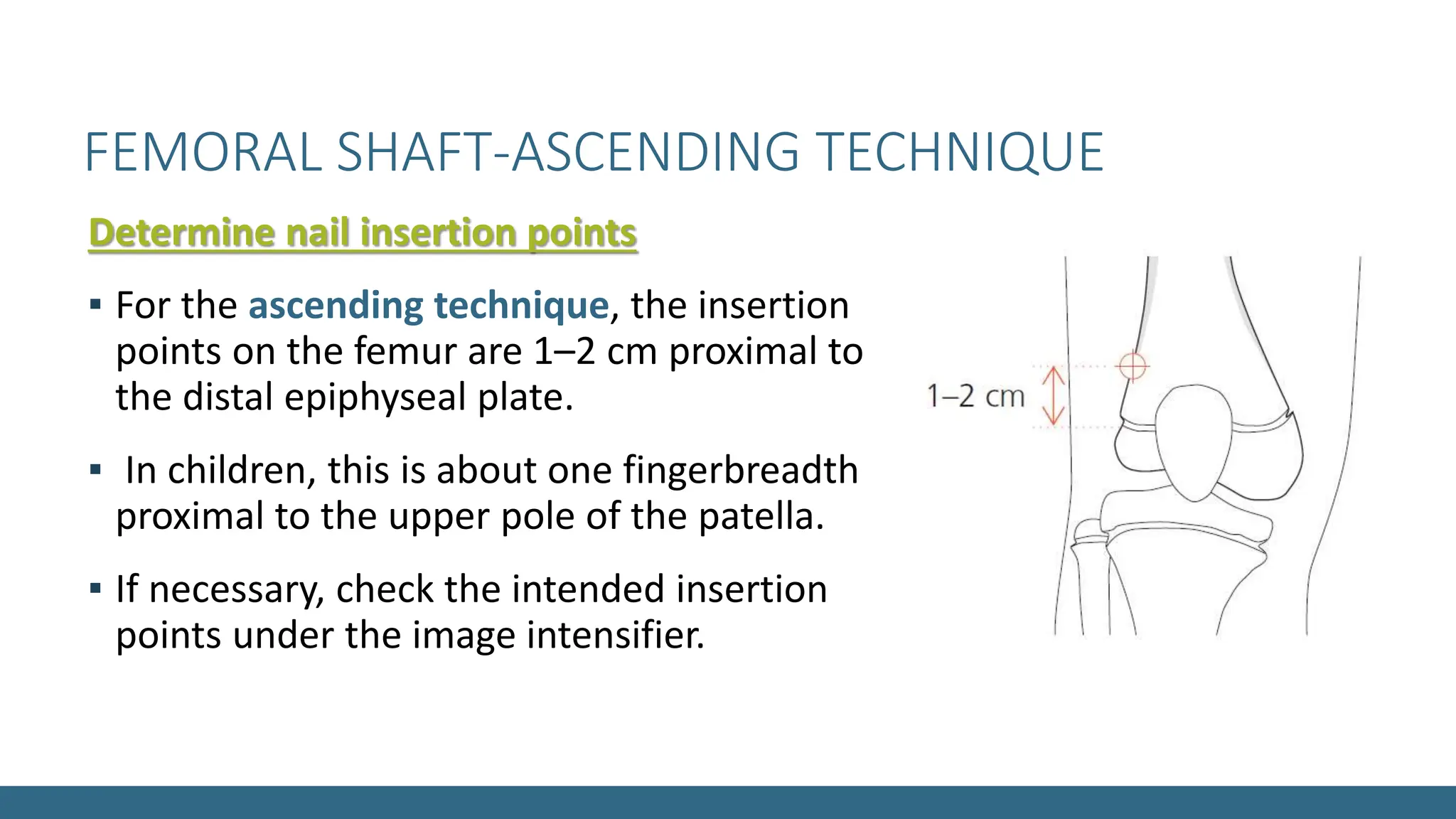 ESIN LOWER LIMB FEMUR AND TIBIA FRACTURES .pptx