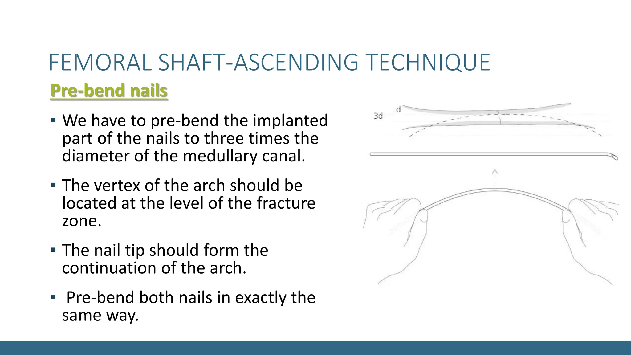 ESIN LOWER LIMB FEMUR AND TIBIA FRACTURES .pptx