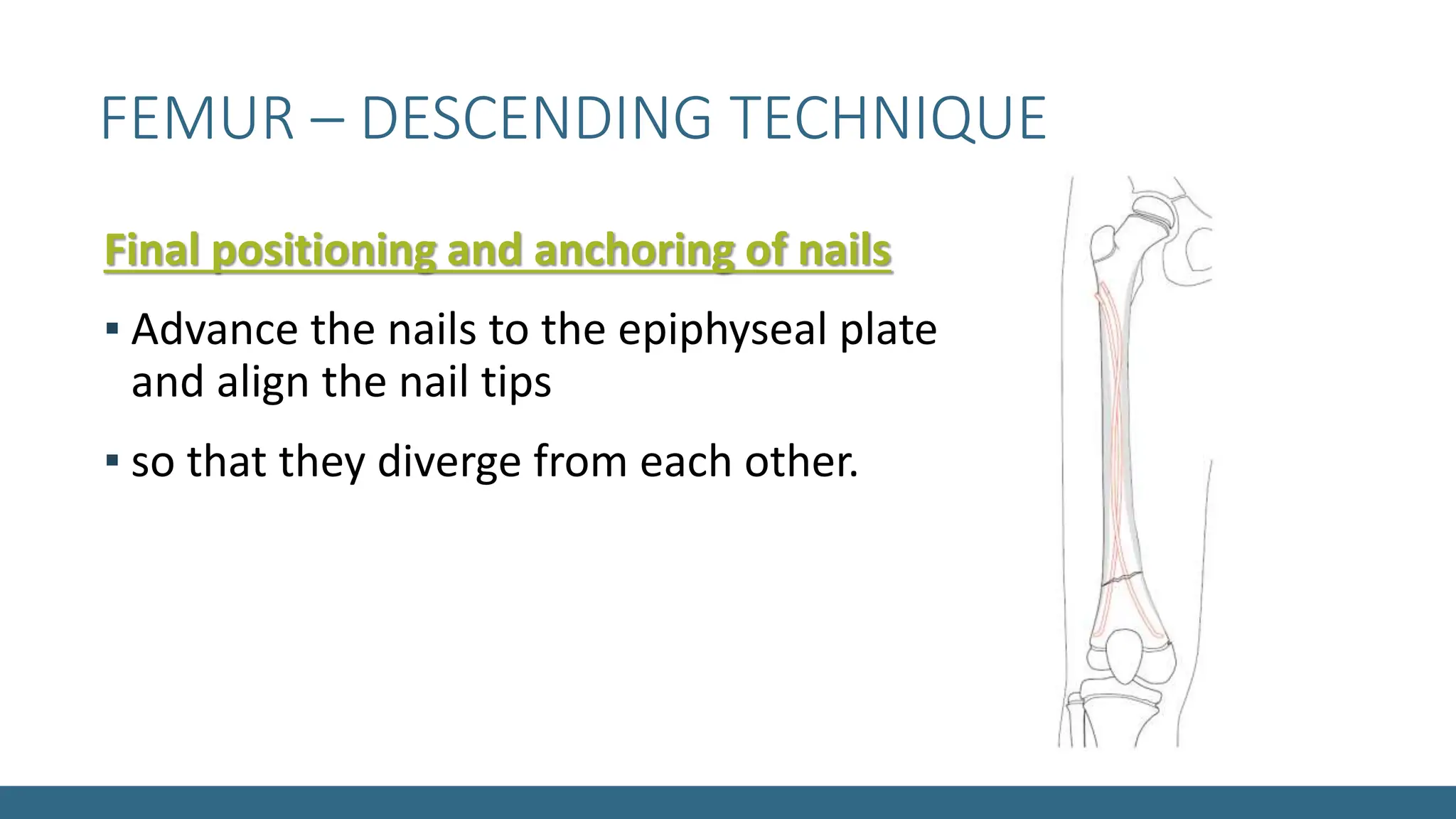 ESIN LOWER LIMB FEMUR AND TIBIA FRACTURES .pptx
