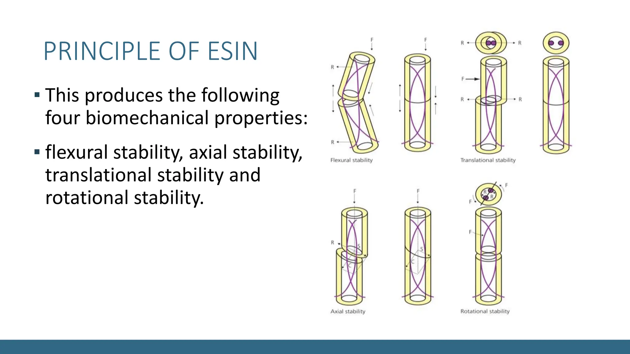 ESIN LOWER LIMB FEMUR AND TIBIA FRACTURES .pptx