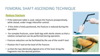ESIN LOWER LIMB FEMUR AND TIBIA FRACTURES .pptx