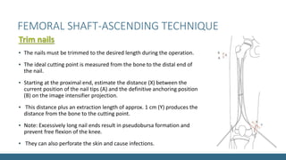 ESIN LOWER LIMB FEMUR AND TIBIA FRACTURES .pptx