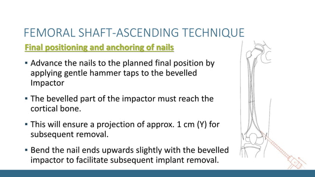 ESIN LOWER LIMB FEMUR AND TIBIA FRACTURES .pptx