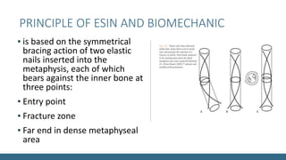 ESIN LOWER LIMB FEMUR AND TIBIA FRACTURES .pptx