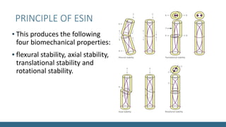 ESIN LOWER LIMB FEMUR AND TIBIA FRACTURES .pptx