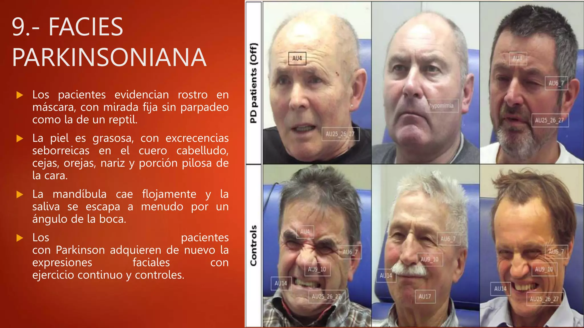 TIPOS DE FACIES | PPTX | Eye and Vision Conditions | Diseases and ...