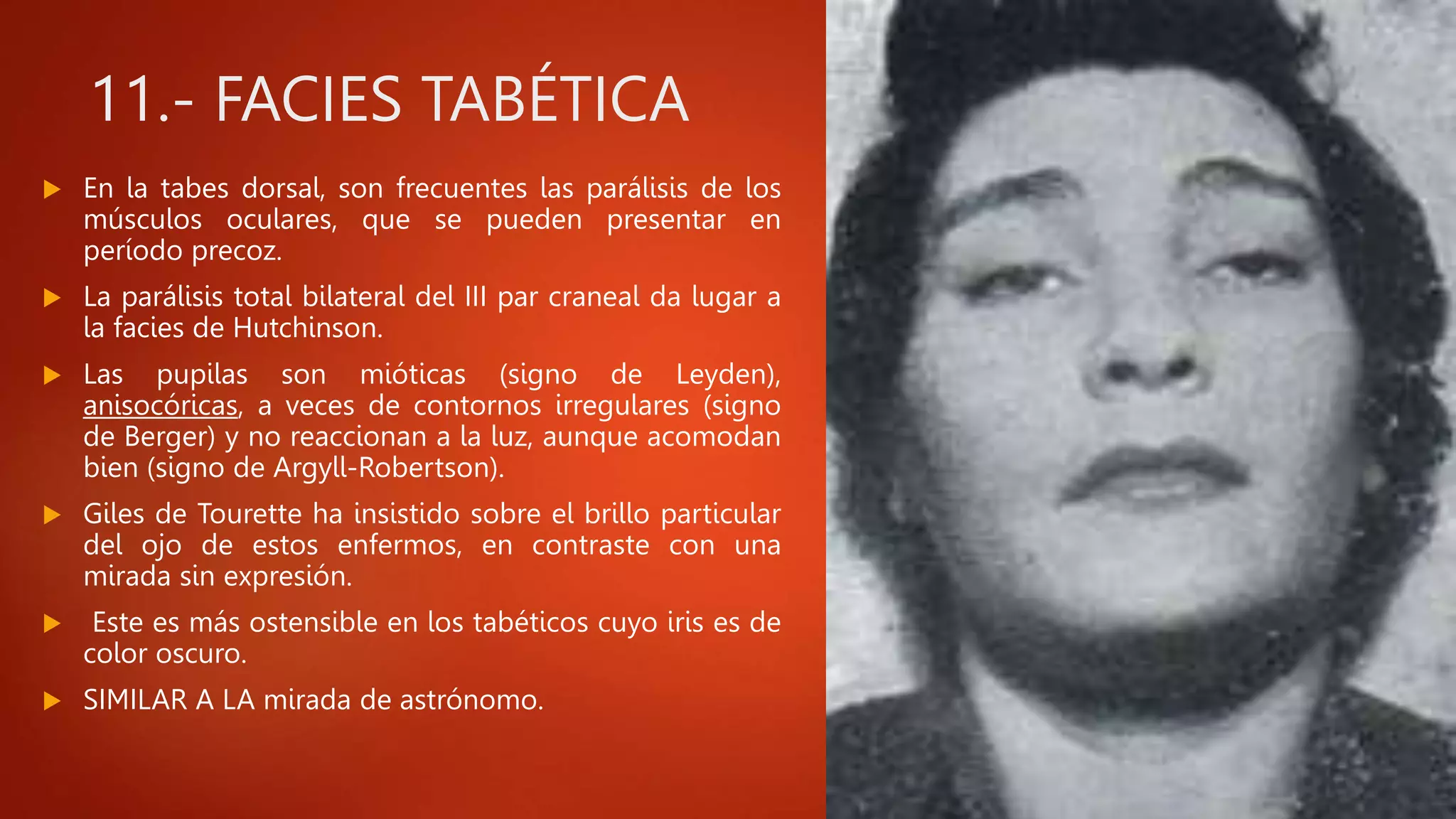 TIPOS DE FACIES | PPTX | Eye and Vision Conditions | Diseases and ...