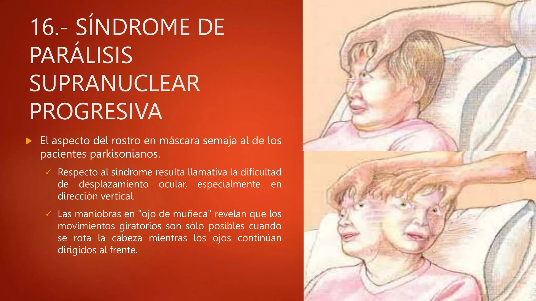 TIPOS DE FACIES | PPTX | Eye and Vision Conditions | Diseases and ...