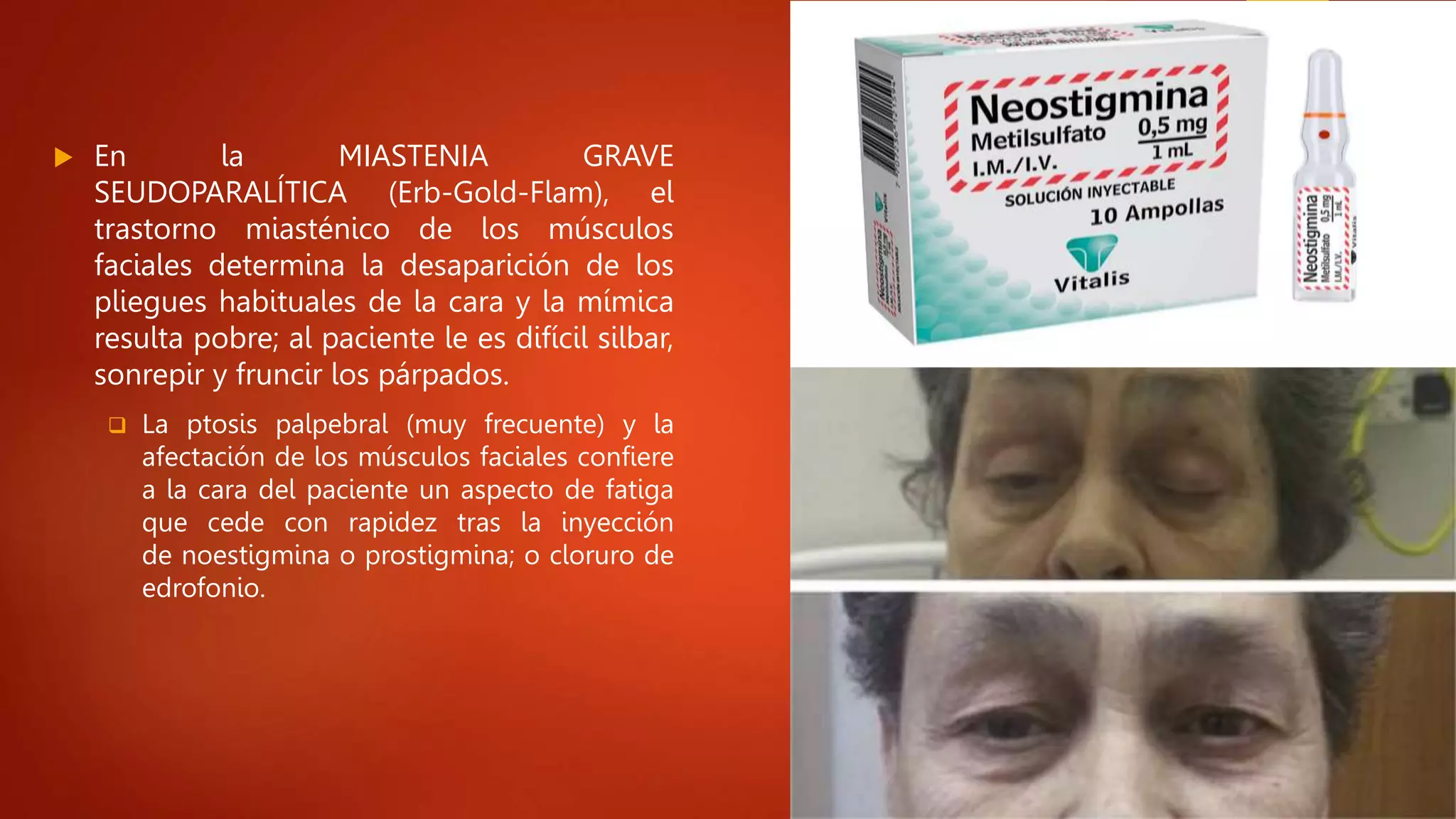 TIPOS DE FACIES | PPTX | Eye and Vision Conditions | Diseases and ...