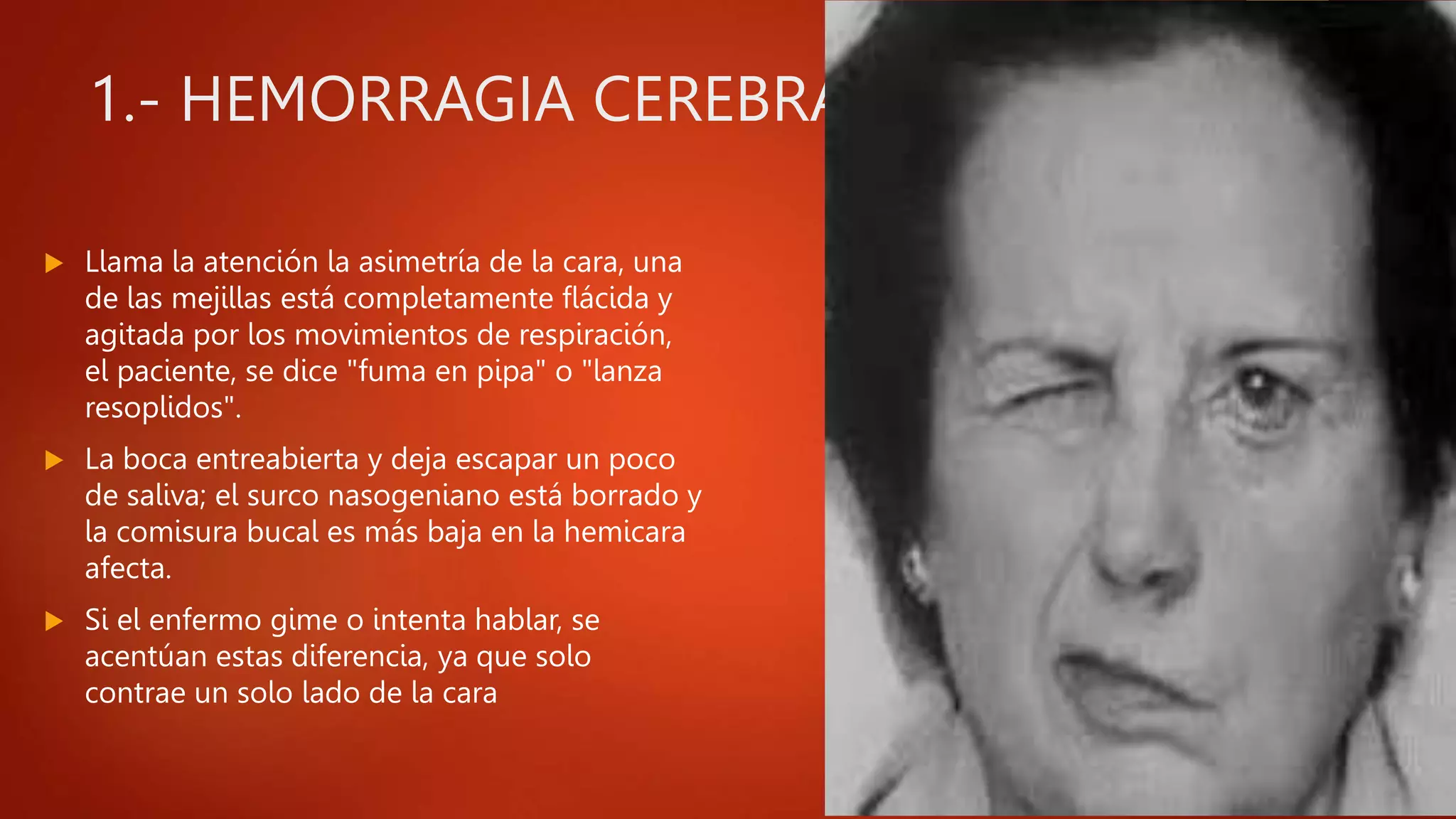 TIPOS DE FACIES | PPTX | Eye and Vision Conditions | Diseases and ...