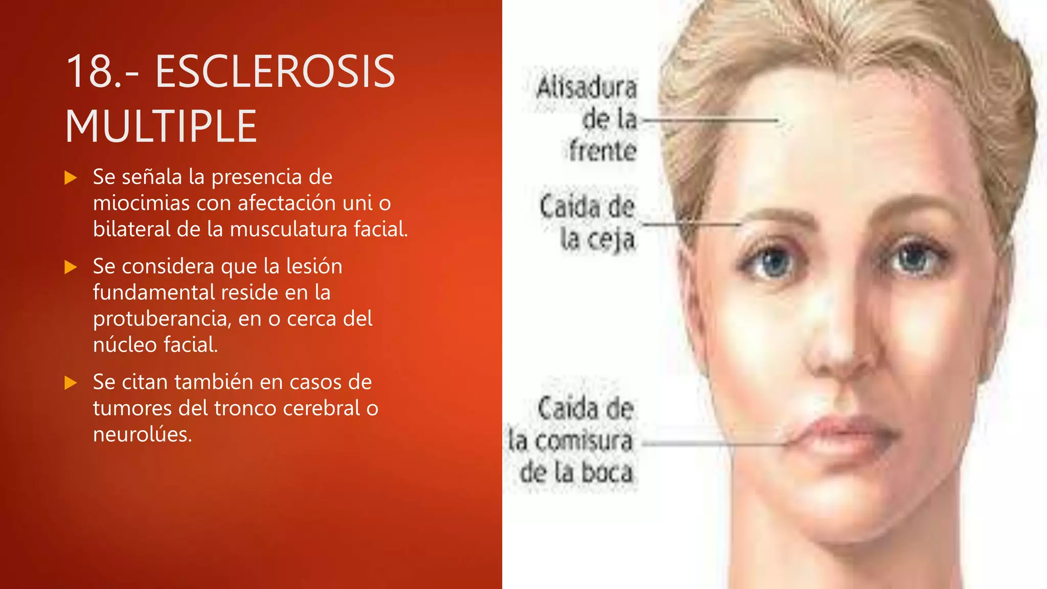 TIPOS DE FACIES | PPTX | Eye and Vision Conditions | Diseases and ...