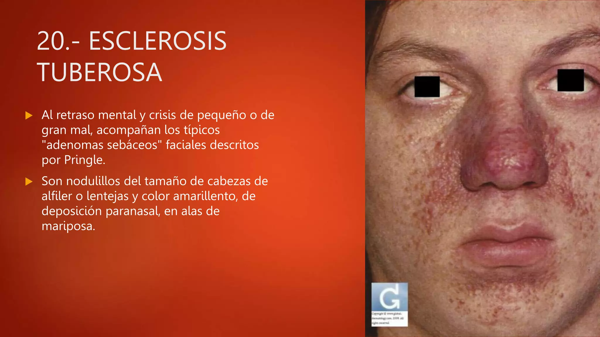 TIPOS DE FACIES | PPTX | Eye and Vision Conditions | Diseases and ...