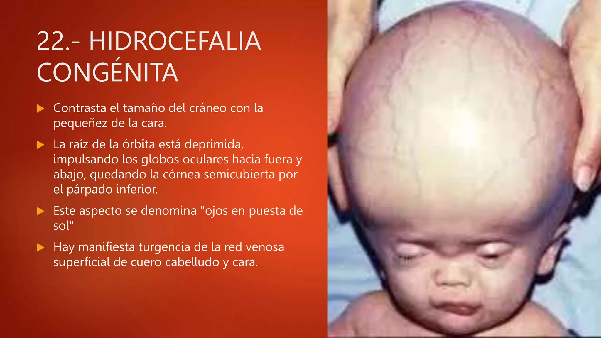 TIPOS DE FACIES | PPTX | Eye and Vision Conditions | Diseases and ...