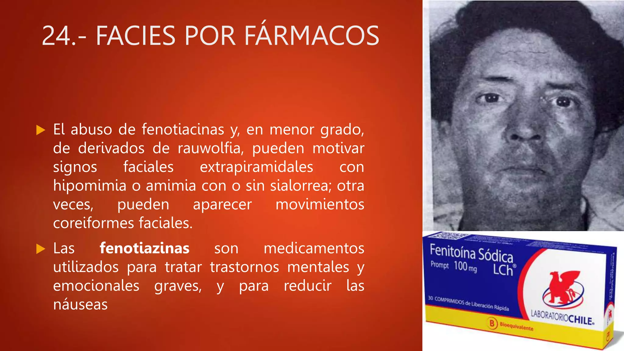 TIPOS DE FACIES | PPTX | Eye and Vision Conditions | Diseases and ...