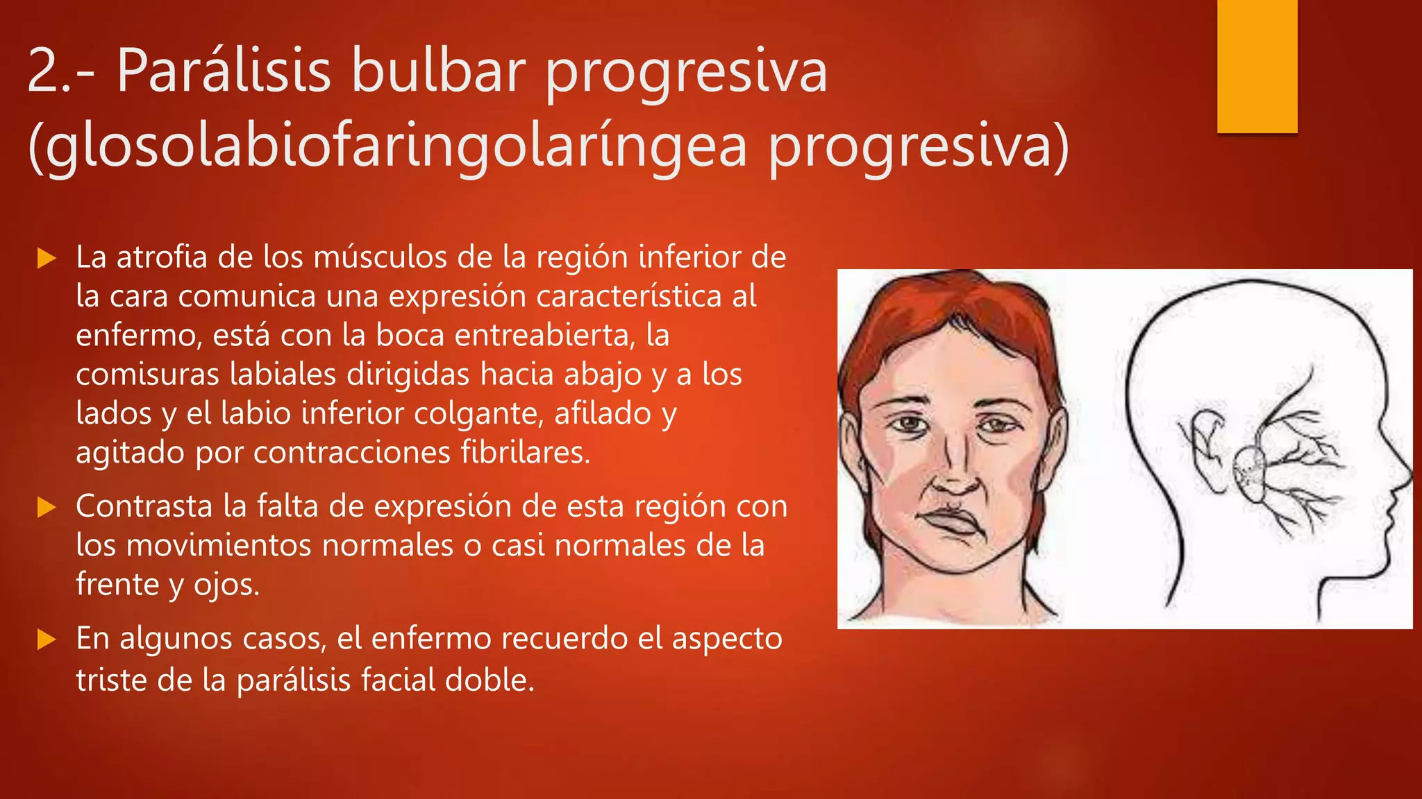 TIPOS DE FACIES | PPTX | Eye and Vision Conditions | Diseases and ...