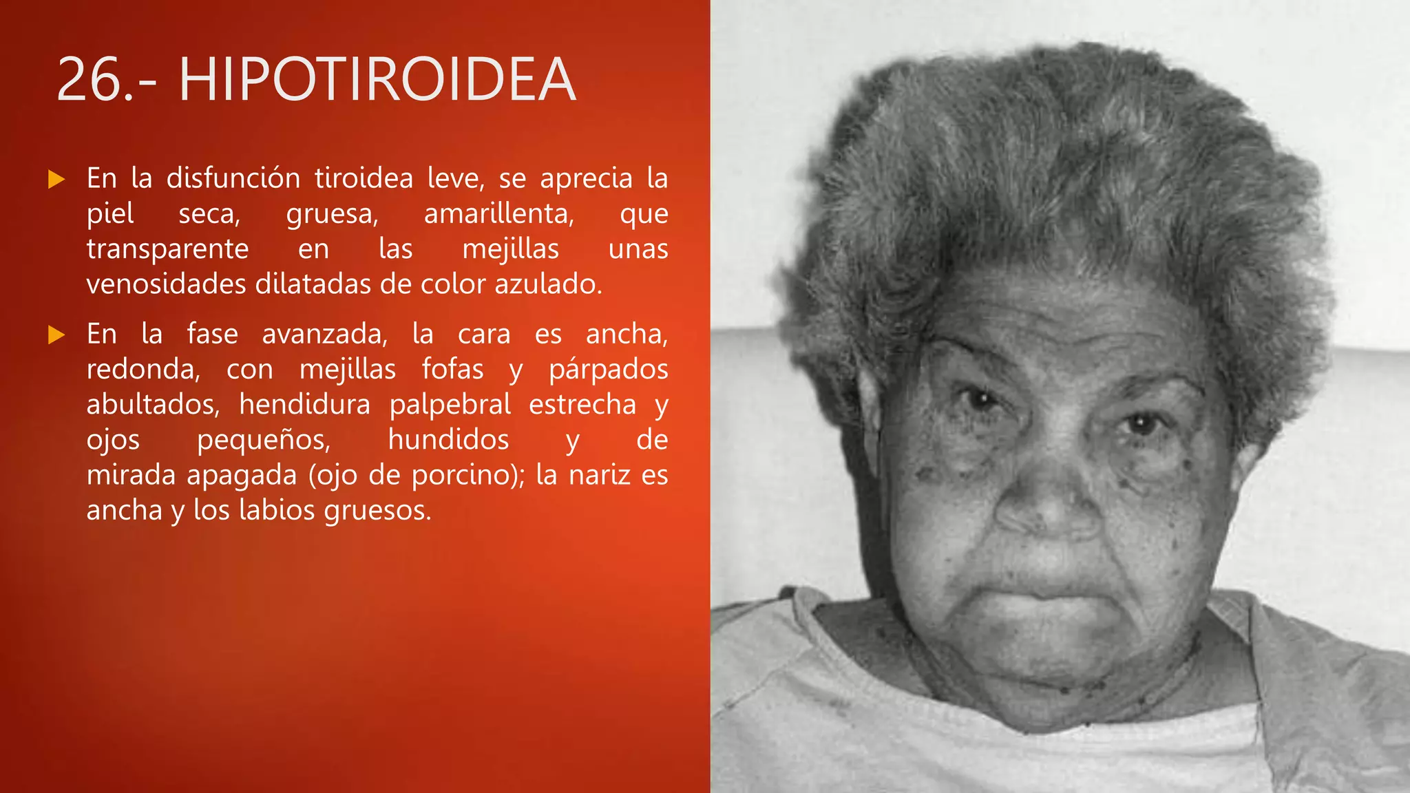 TIPOS DE FACIES | PPTX | Eye and Vision Conditions | Diseases and ...