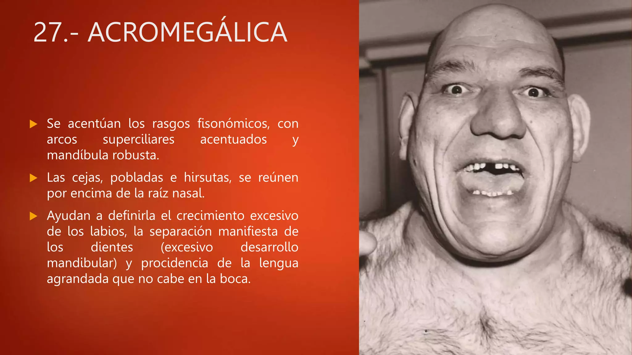TIPOS DE FACIES | PPTX | Eye and Vision Conditions | Diseases and ...