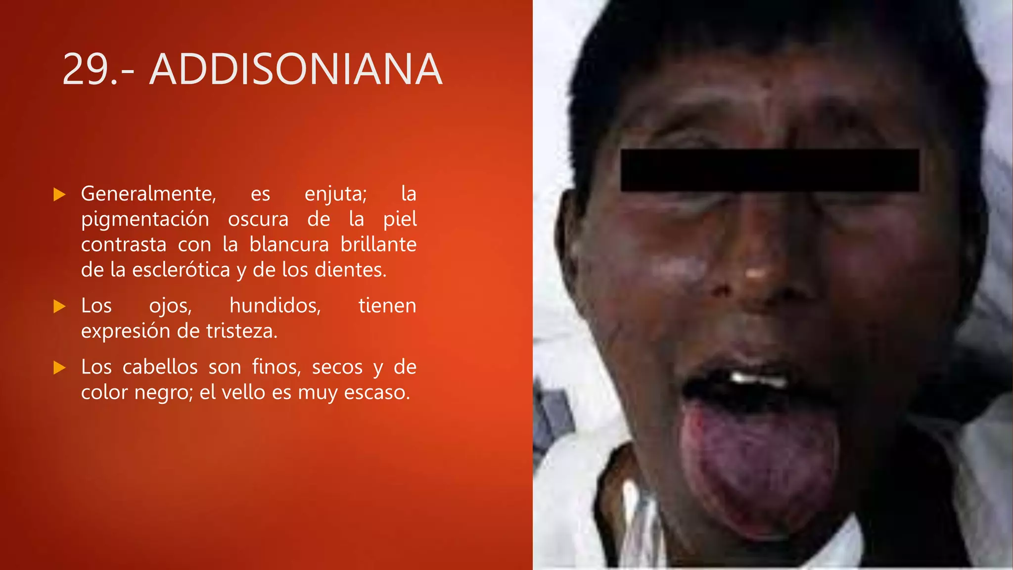 TIPOS DE FACIES | PPTX | Eye and Vision Conditions | Diseases and ...