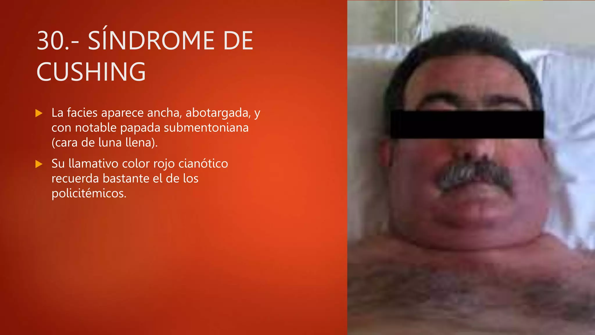 TIPOS DE FACIES | PPTX | Eye and Vision Conditions | Diseases and ...