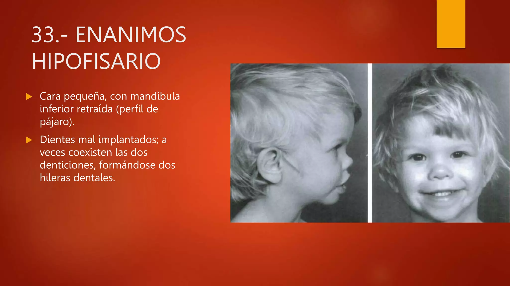 TIPOS DE FACIES | PPTX | Eye and Vision Conditions | Diseases and ...