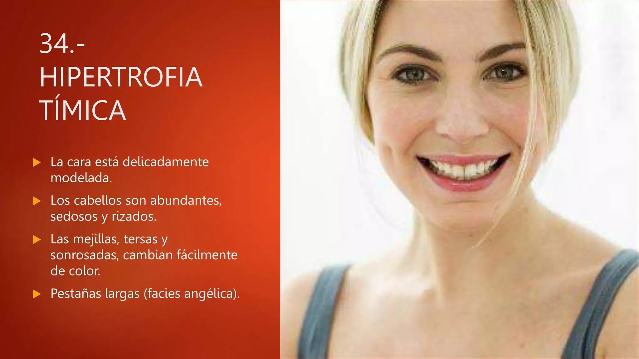 TIPOS DE FACIES | PPTX | Eye and Vision Conditions | Diseases and ...